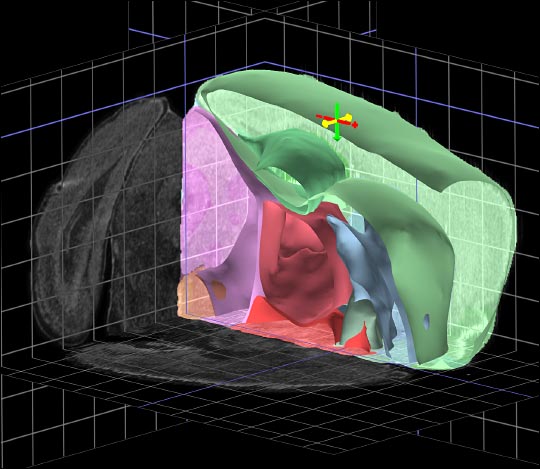 Paul Allen's Brain Atlas: digital, 3D, neural map breakthrough - Boing ...