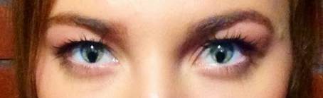 "Cat eye syndrome" (bilateral colobomas) - Boing Boing