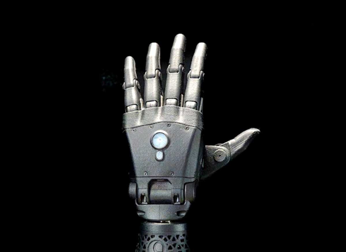 Detachable bionic hands: Teen tests new prosthetic technology - Boing Boing